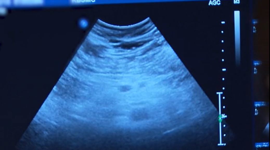 MRI·초음파 부담 늘어난다…의료쇼핑도 '차단' - SBS Biz