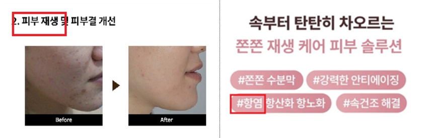 '허위·과대광고' 마이크로니들 화장품 판매광고 적발 - SBS Biz